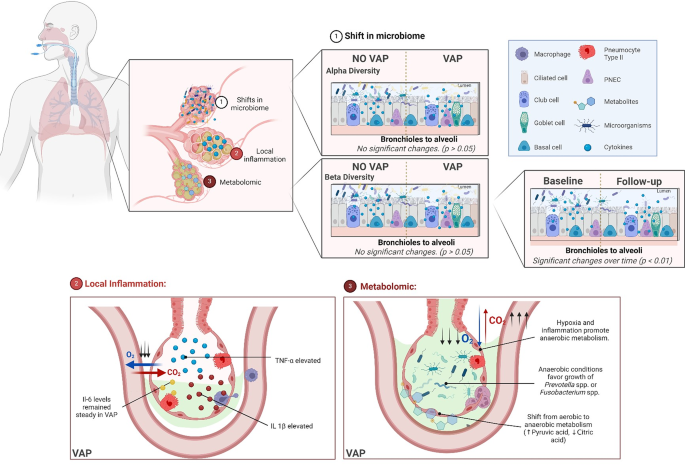 Longitudinal analysis of lung microbiome, immune response, and ...